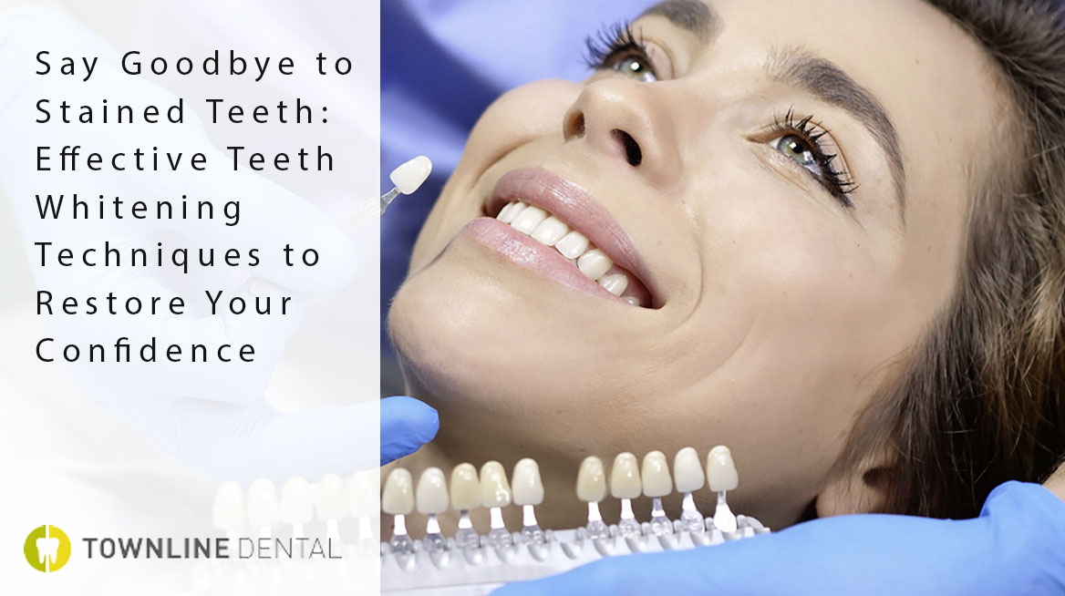 Say Goodbye to Stained Teeth: Effective Teeth Whitening Techniques to ...